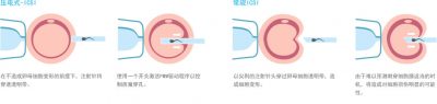压电式胞浆内单精子注射（PIEZO-ICSI） - Best IVF centre | Fertility Treatments | IVF ...